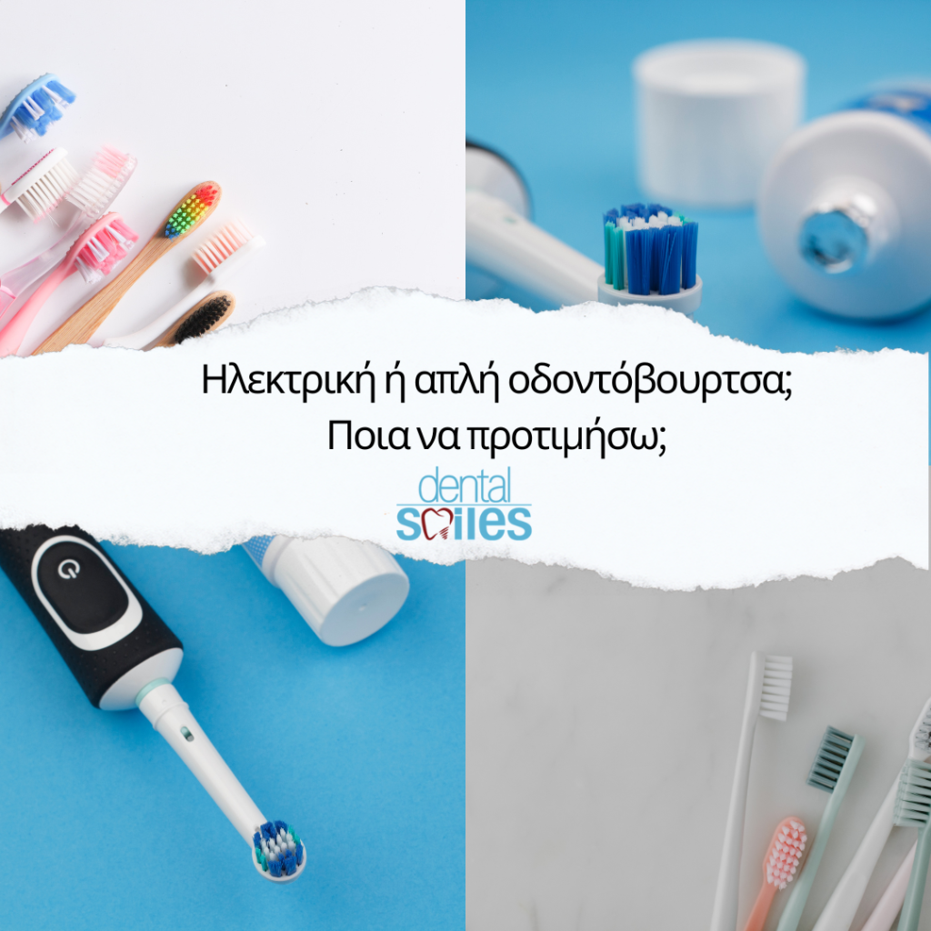 Εμφυτεύματα δοντιών ή γέφυρες; | dentalsmiles