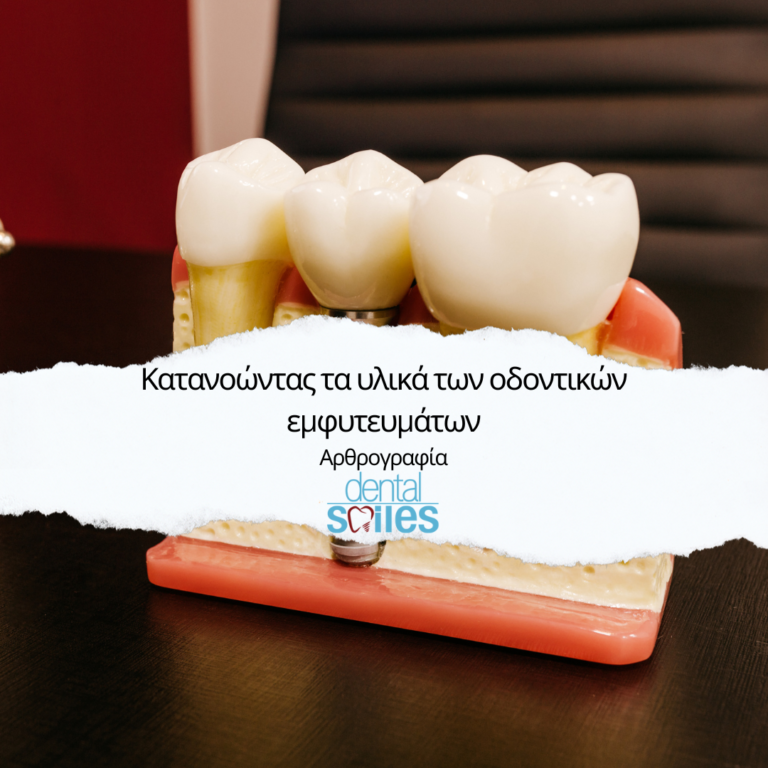 Εμφυτεύματα δοντιών ή γέφυρες; | dentalsmiles